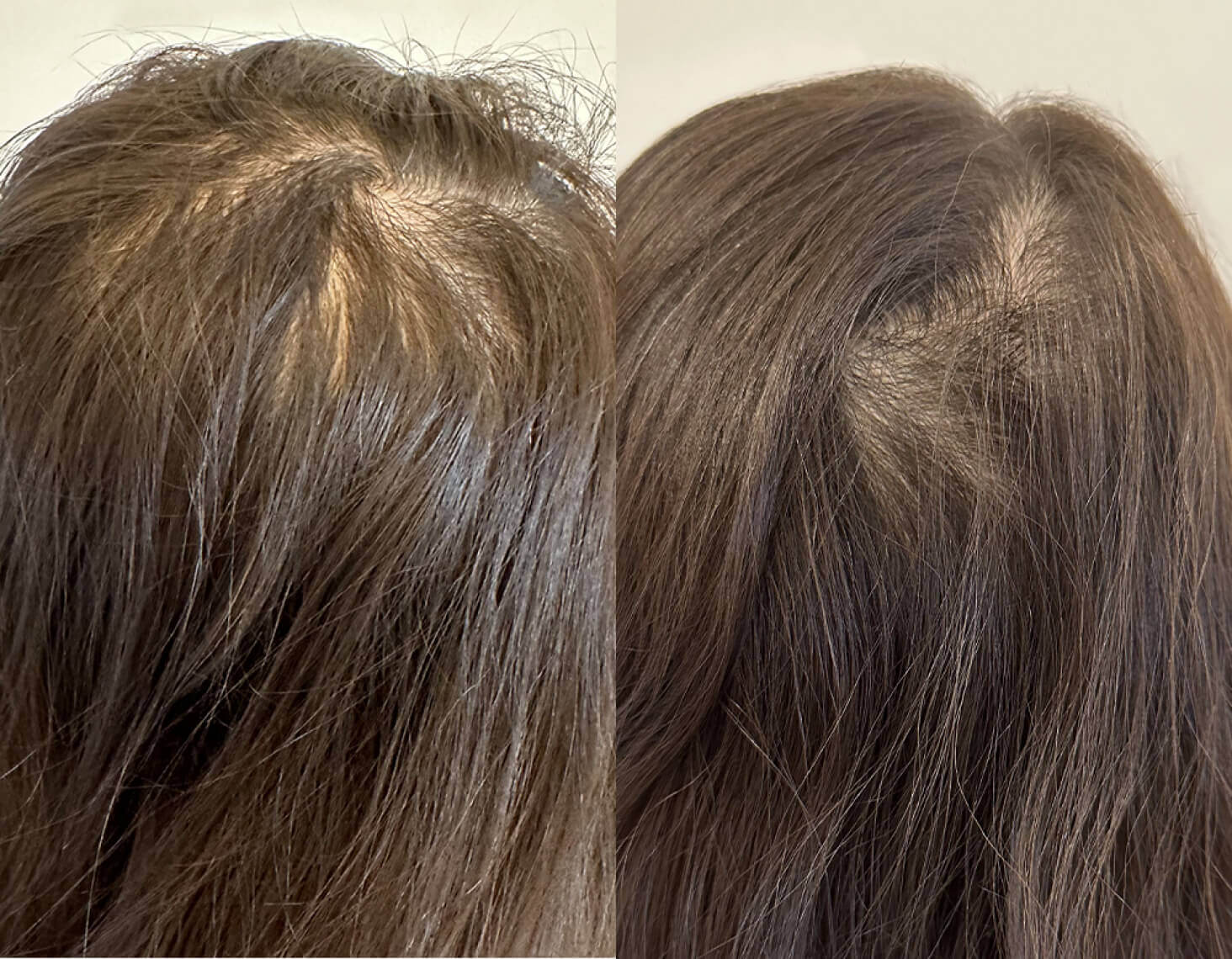 Feel Hair Support | Feel - Wellness, Reimagined