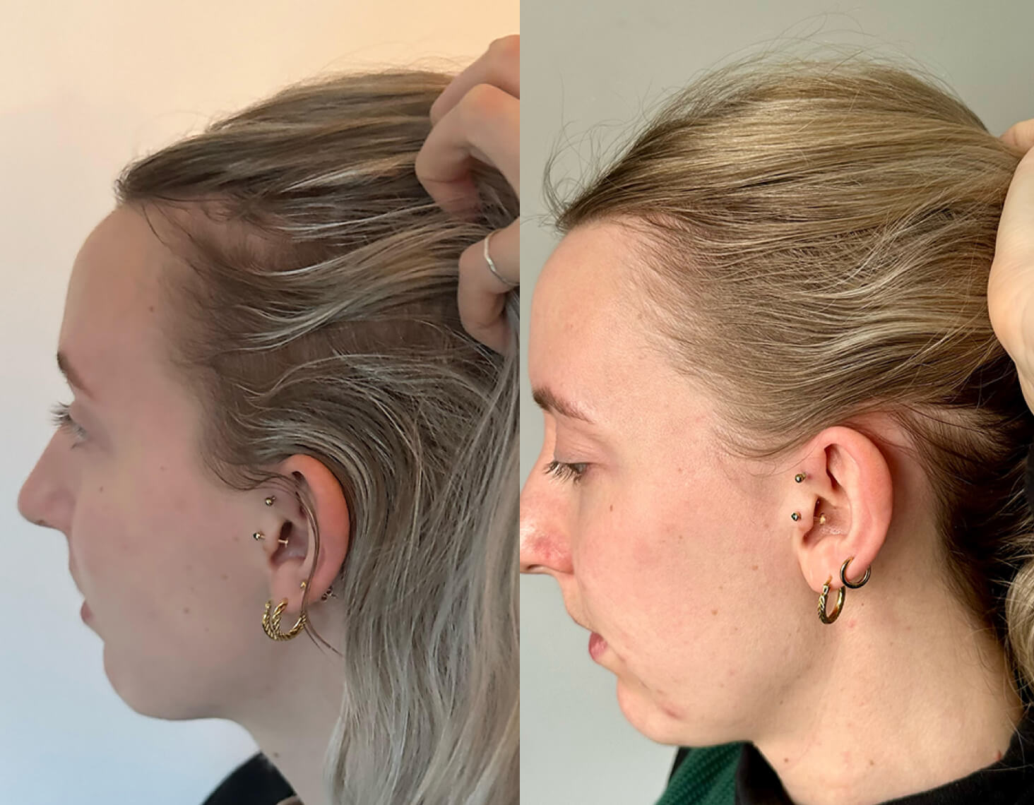 Feel Hair Support | Feel - Wellness, Reimagined