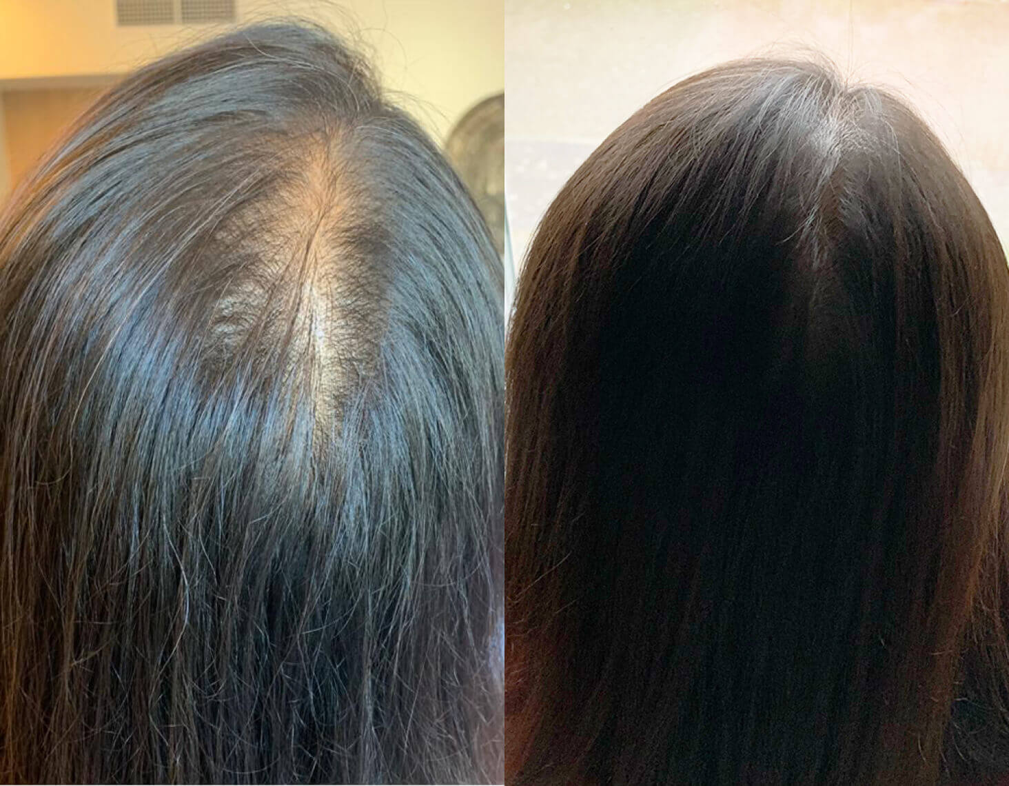 Feel Hair Support | Feel - Wellness, Reimagined