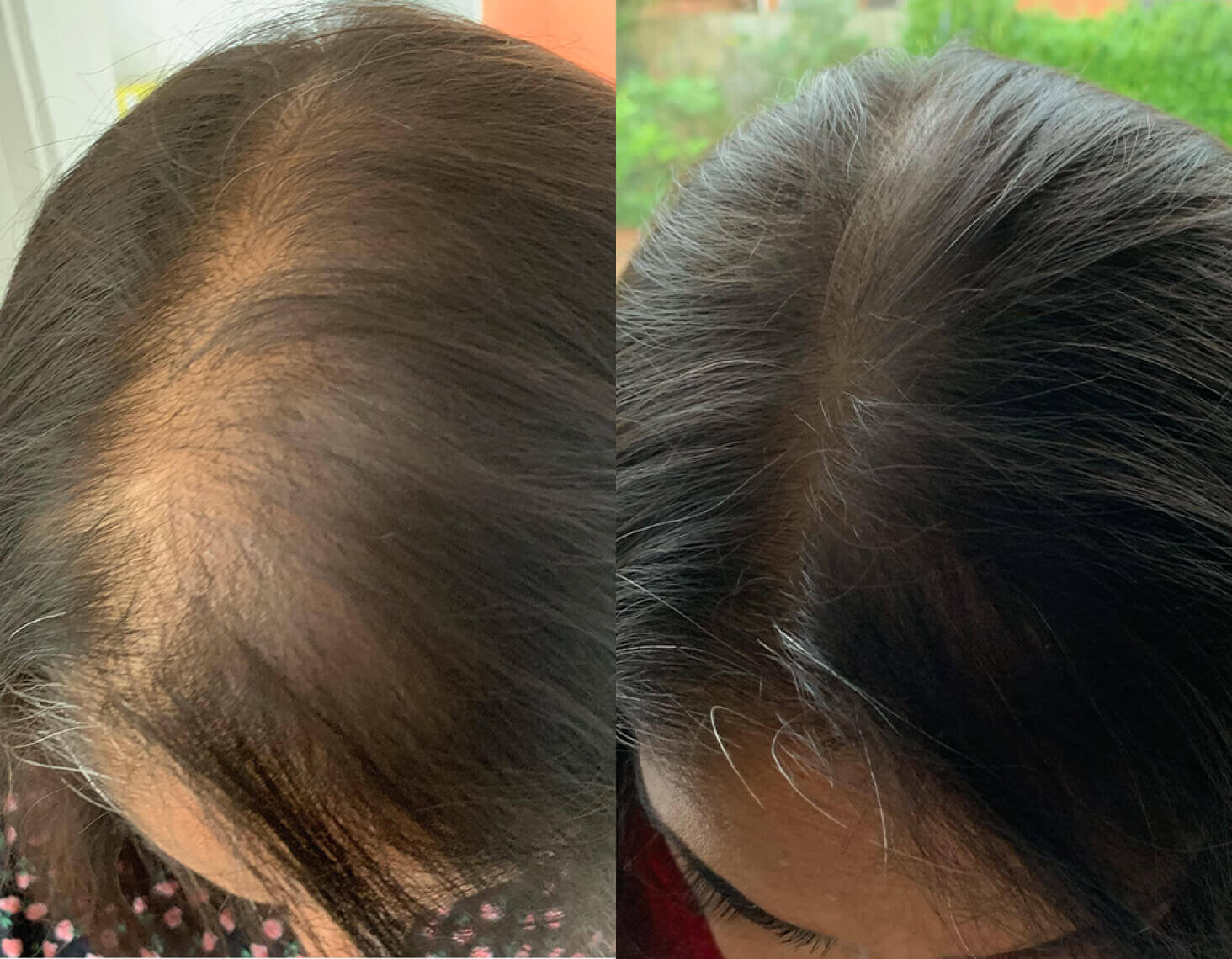 Feel Hair Support | Feel - Wellness, Reimagined