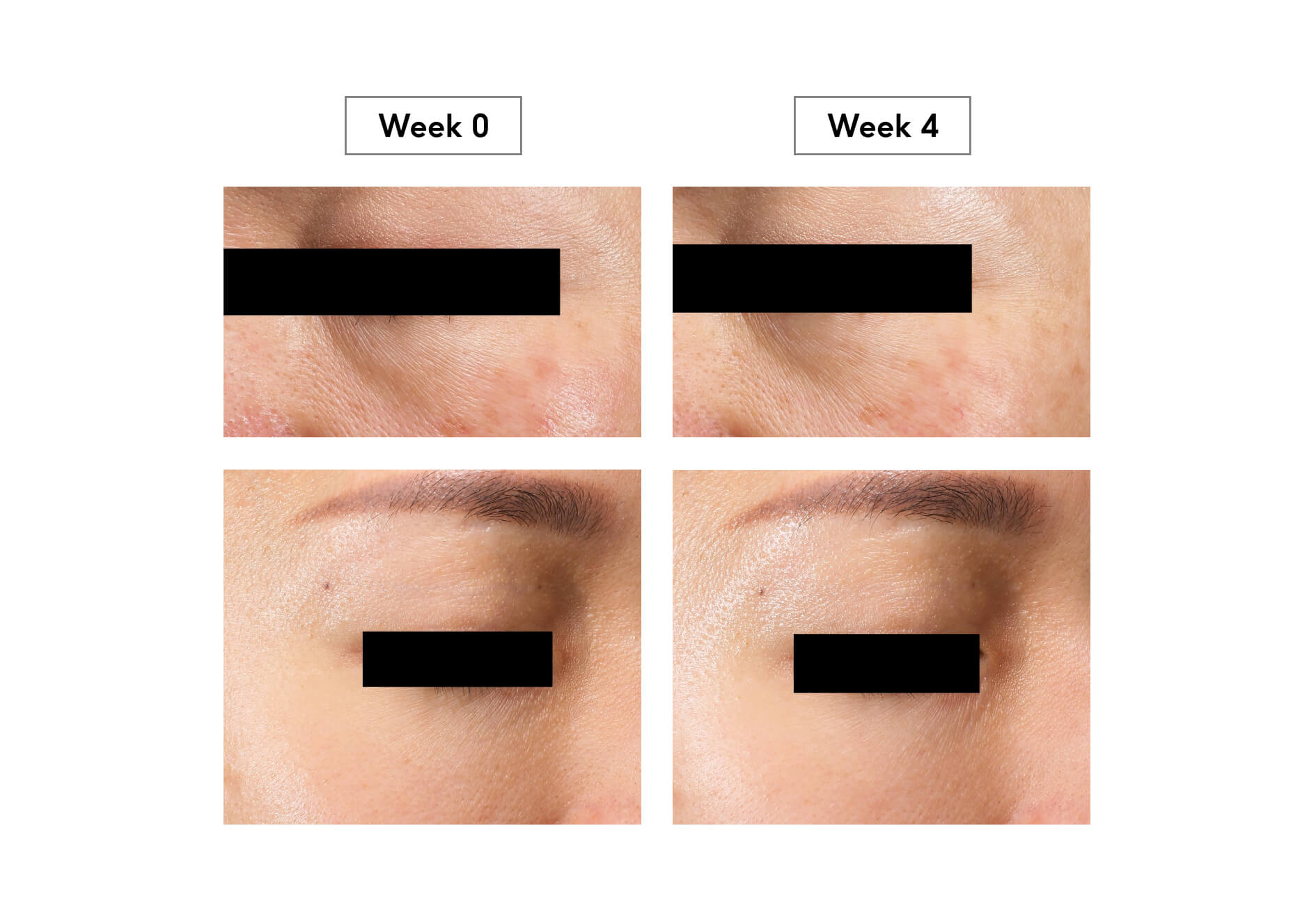 Collagen science | Feel - Wellness, Reimagined