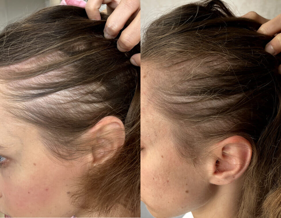 Feel Hair Support | Feel - Wellness, Reimagined