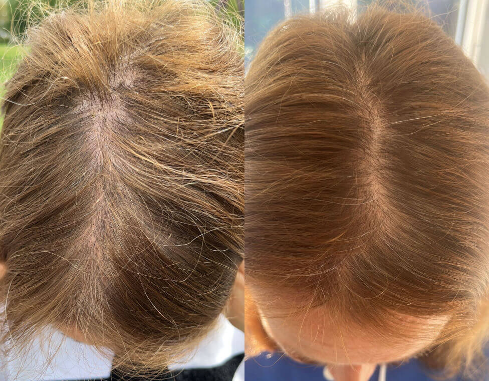 Feel Hair Support | Feel - Wellness, Reimagined