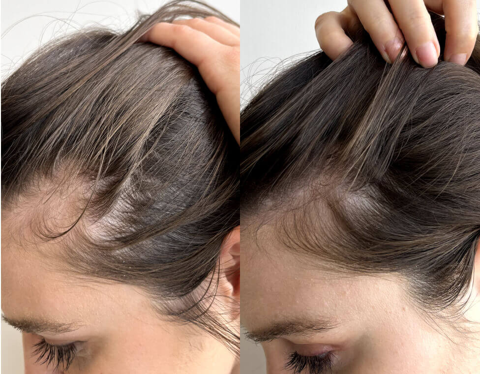 Feel Hair Support 30 day supply (one-time box) | Feel - Wellness ...