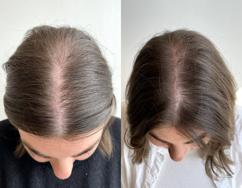Feel Hair Support | Feel - Wellness, Reimagined