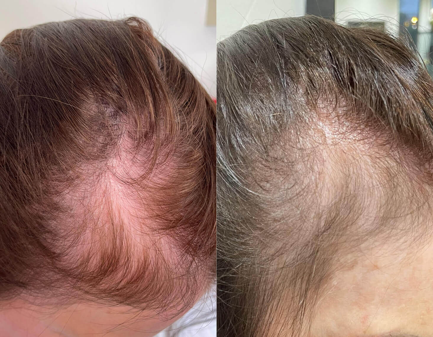 Feel Hair Support | Feel - Wellness, Reimagined